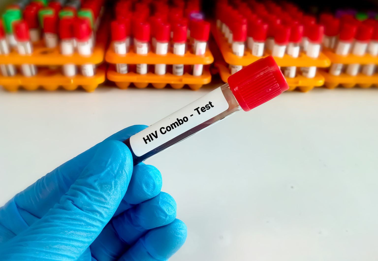 Teste de HIV convencional ou teste rápido? Veja a diferença entre eles.